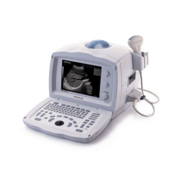 Mindray 1100 plus Portable Ultrasound - Digital Ultra Sounds