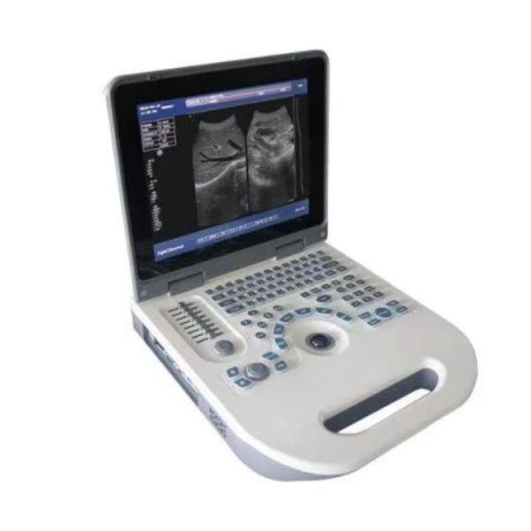 Nyro 10 portable ultrasound Machine - Digital Ultra Sounds