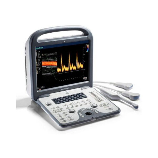 SonoScape S6 portable echo - Digital Ultra Sounds