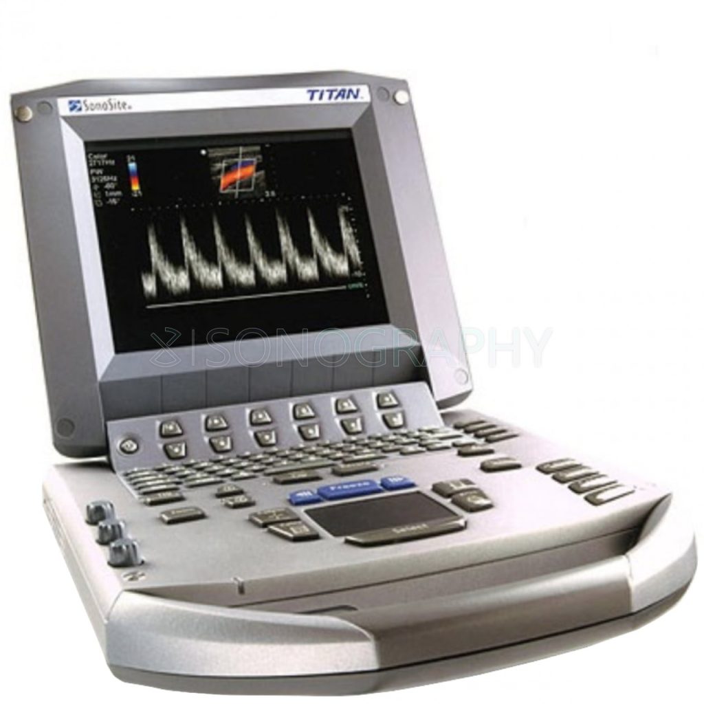 Fujifilm Sonosite Titan Portable Ultrasound - Digital Ultra Sounds