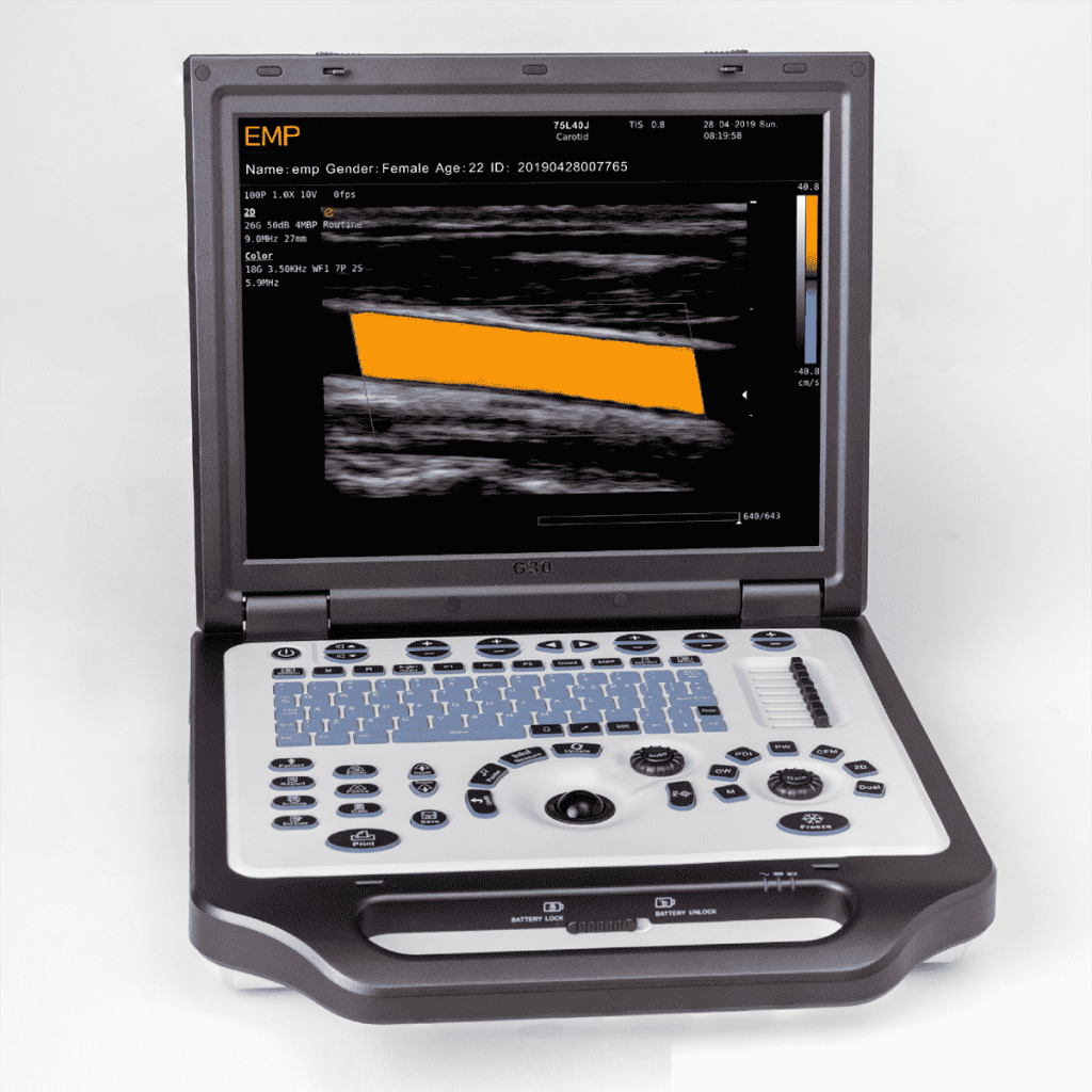 Emperor EMP G30 Portable Color doplor - Digital Ultra Sounds